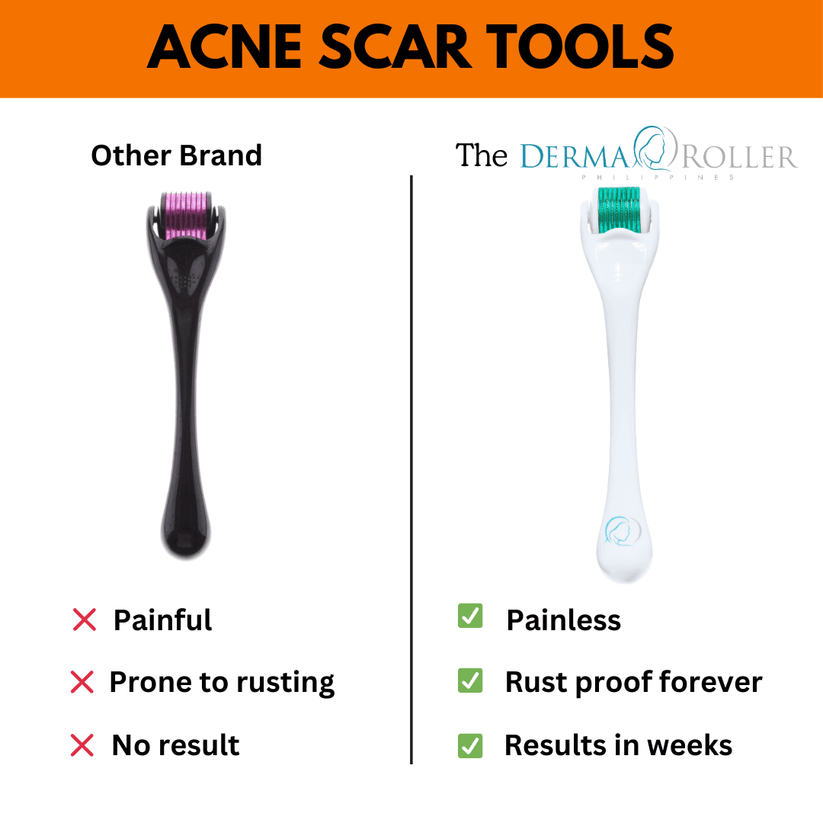 Original Derma Roller – Derma Roller Philippines