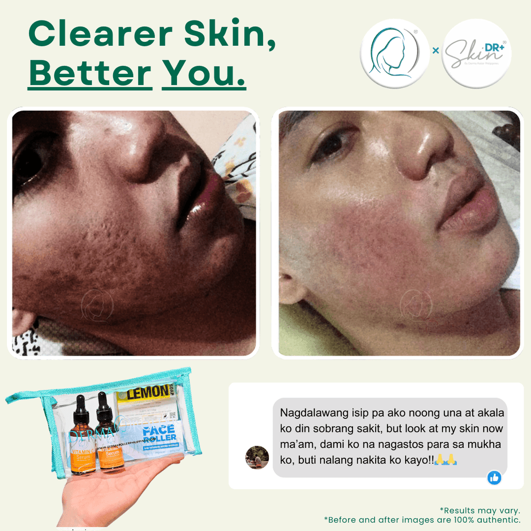 Derma Roller Philippines | Original Microneedling & Skincare Tools